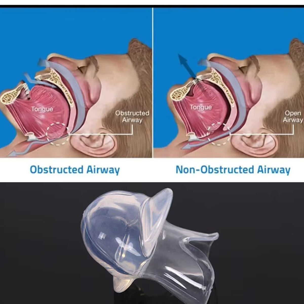 Silicone Anti-Snoring Tongue Device– Verneza